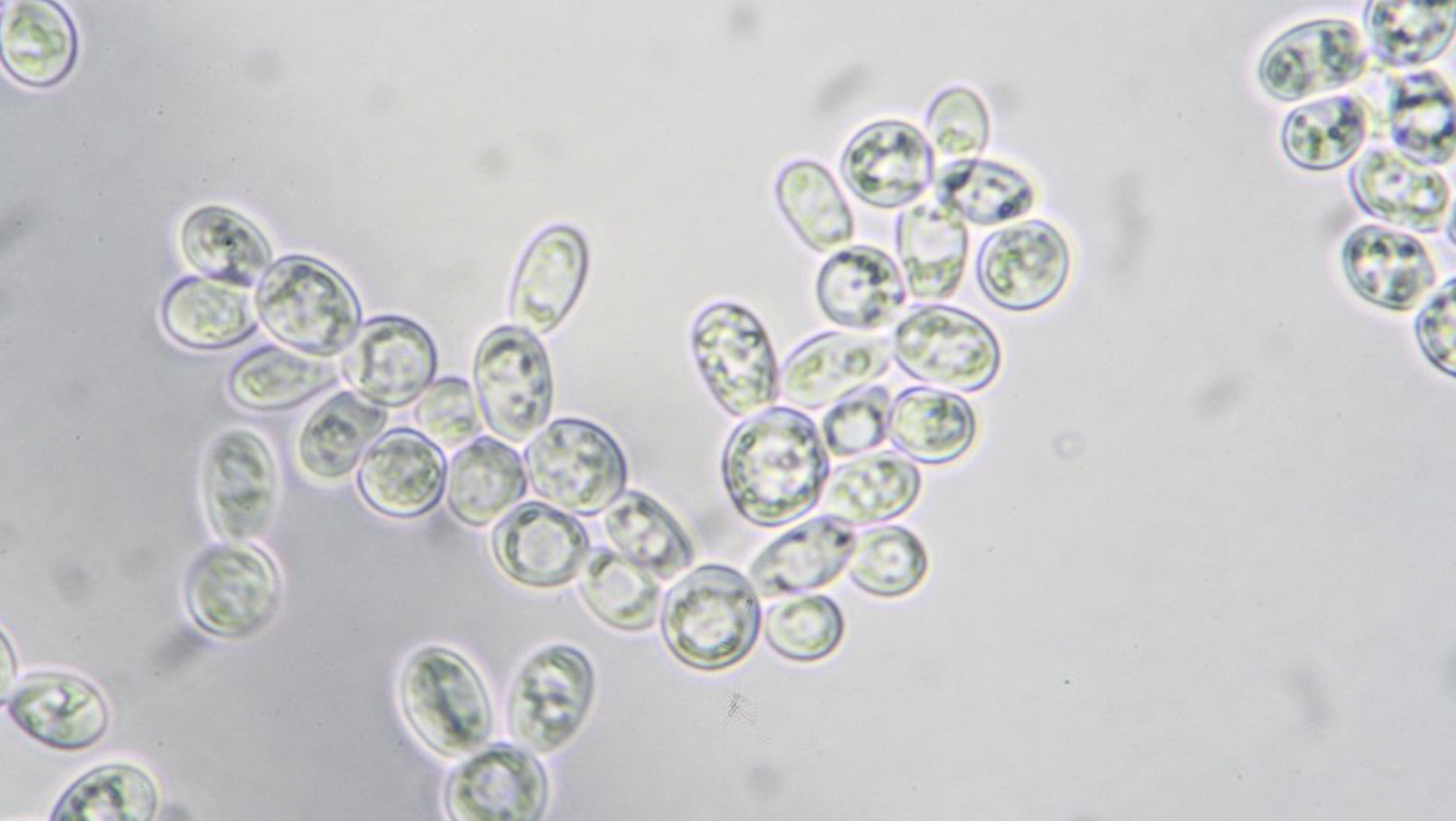 Un estudio en levaduras sin precedentes contribuye al conocimient